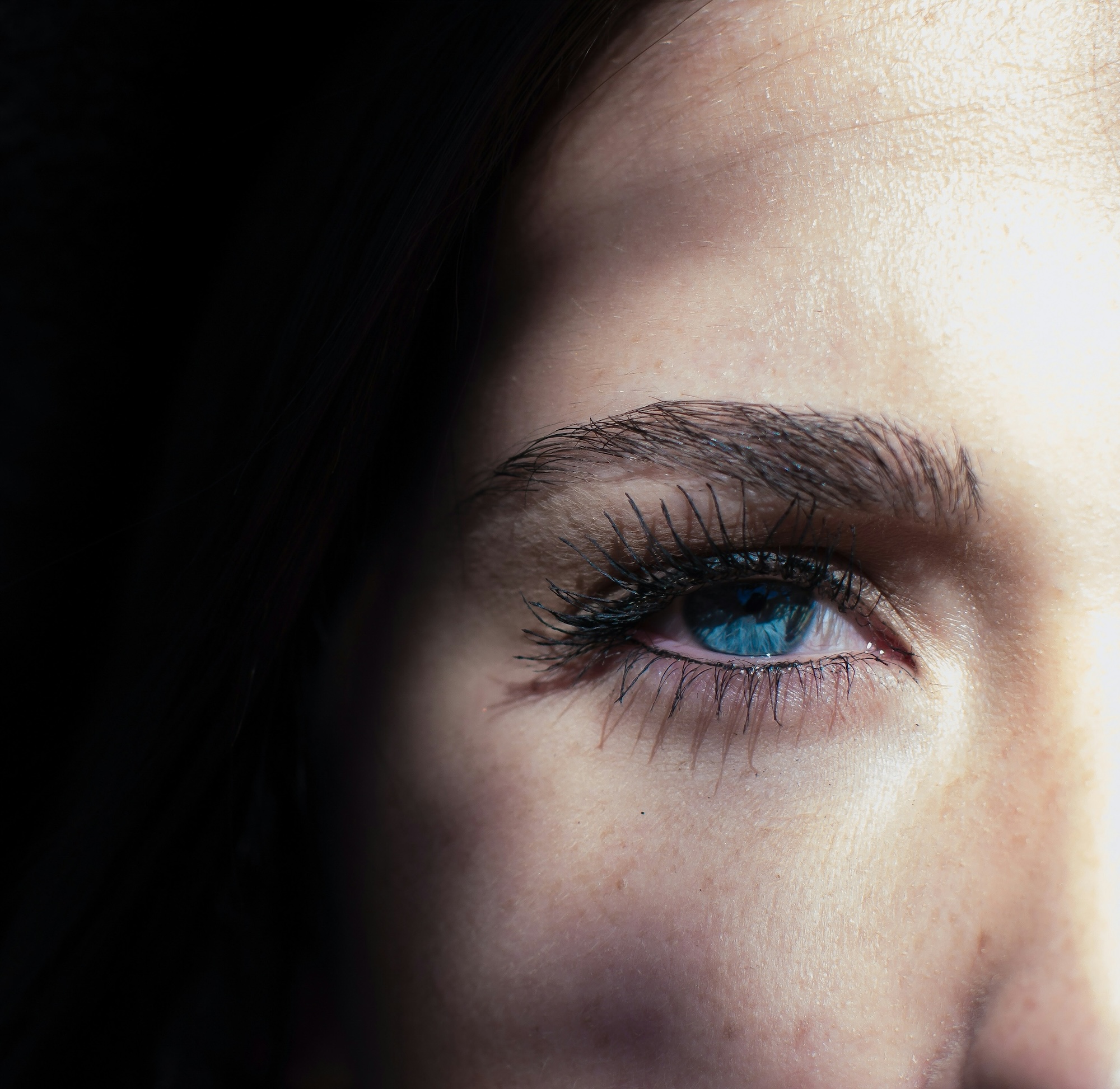 Under Eye Filler Newcastle | Radiant Eye Reset at NSC